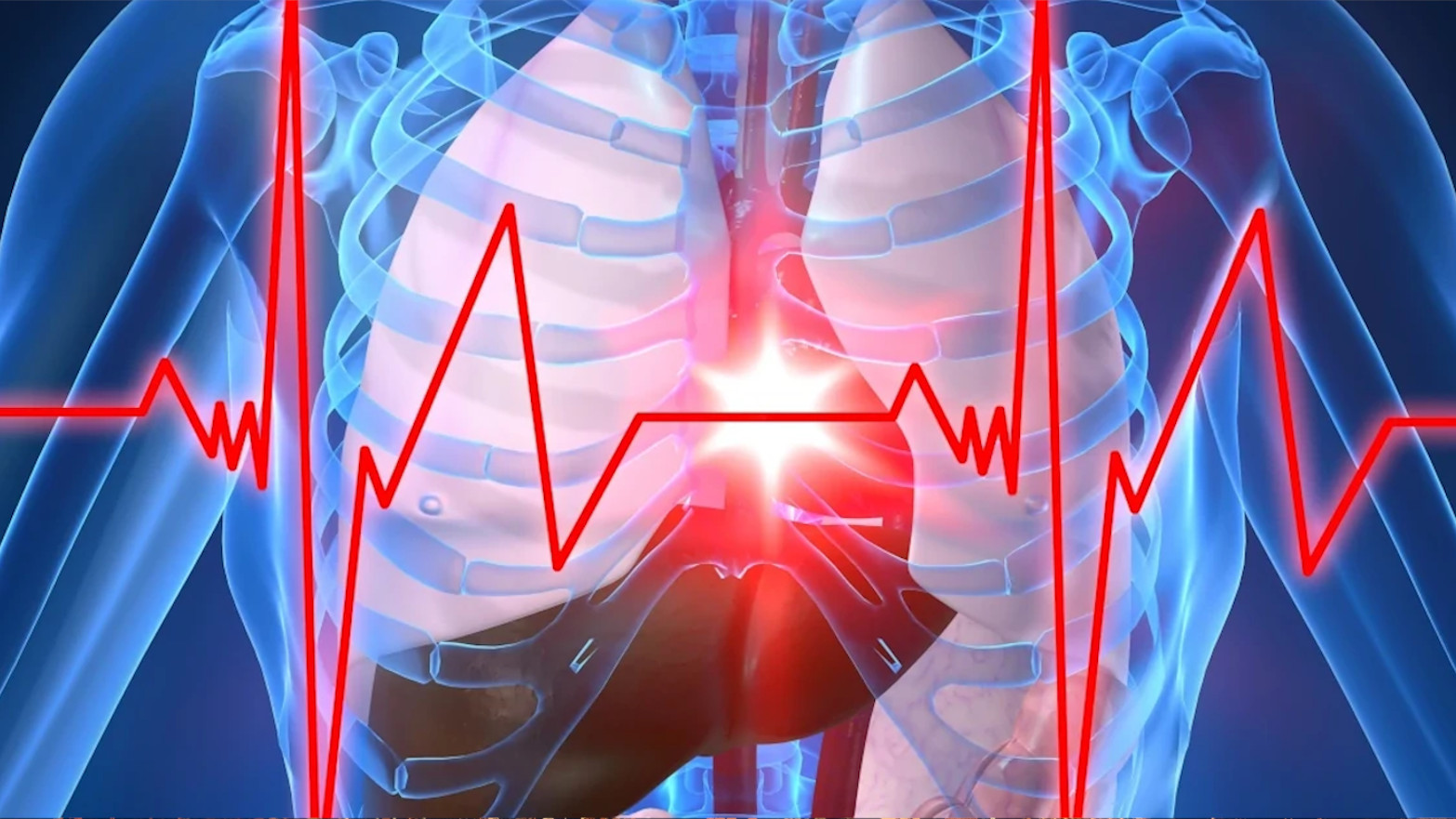 Prediction of death from heart failure